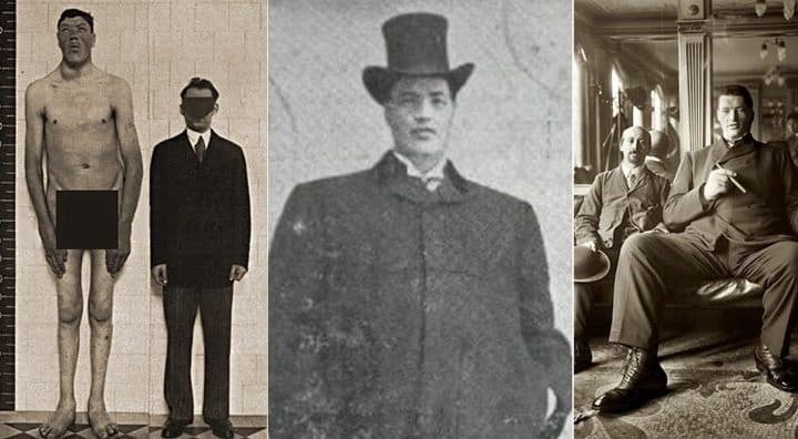 The Tragic Story Of Adam Rainer Who Born A Dwarf Grew Into A Giant